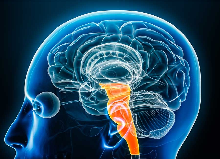 Arnold Chiari Syndrome – Dr. Çağrı Canbolat