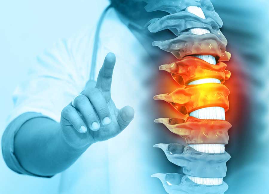 Omurga Enfeksiyonları (Spondilodiskitis) Cerrahi Tedavisi – Tedaviler ...